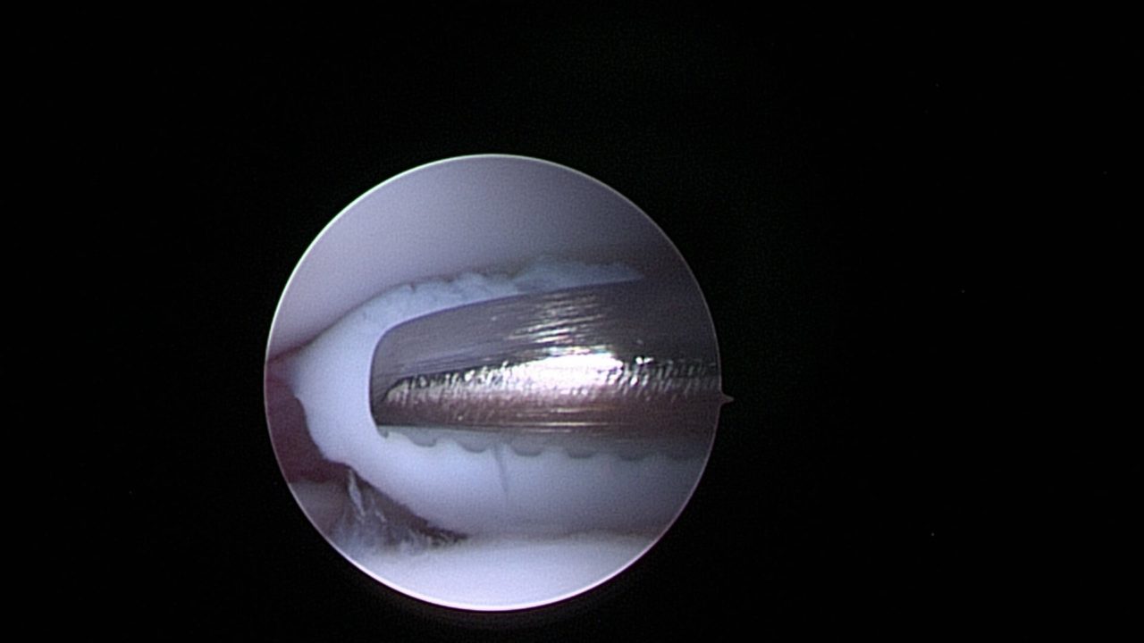 Canine Shoulder Disorders In Shawnee, KS 66218 | Kansas City Canine ...