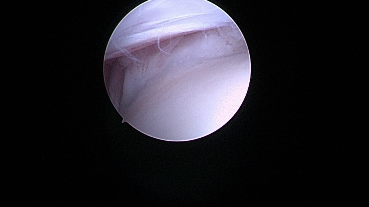 Canine Shoulder Disorders In Shawnee, KS 66218 | Kansas City Canine ...